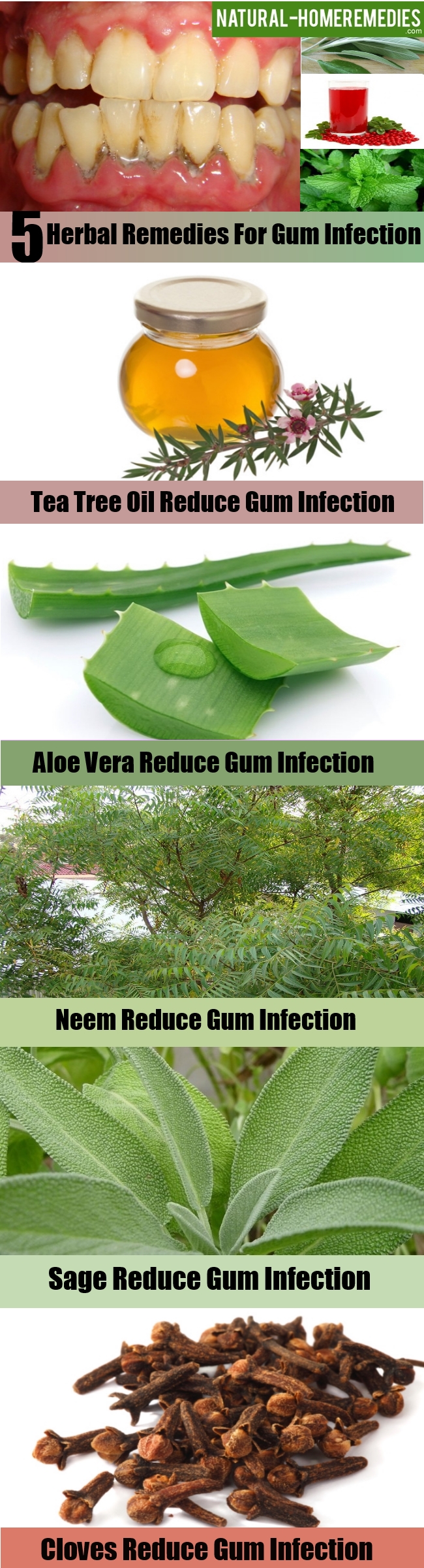 Top 5 Herbal Remedies For Gum Infection – Natural Home Remedies ... Top 5 Herbal Remedies For Gum Infection – Natural Home Remedies ...